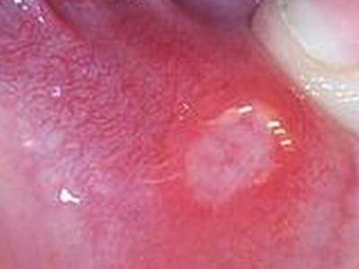 主な皮膚の病気一覧・症例画像【医師が解説】 [皮膚・爪・髪の病気] All About